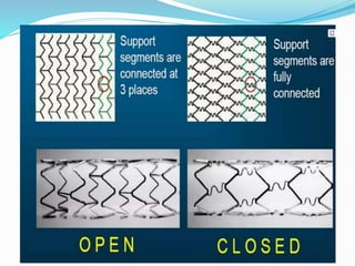 Overview of Stents in Interventional Radiology.pptx
