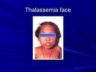 Overview of thalassemia 2 | PPT