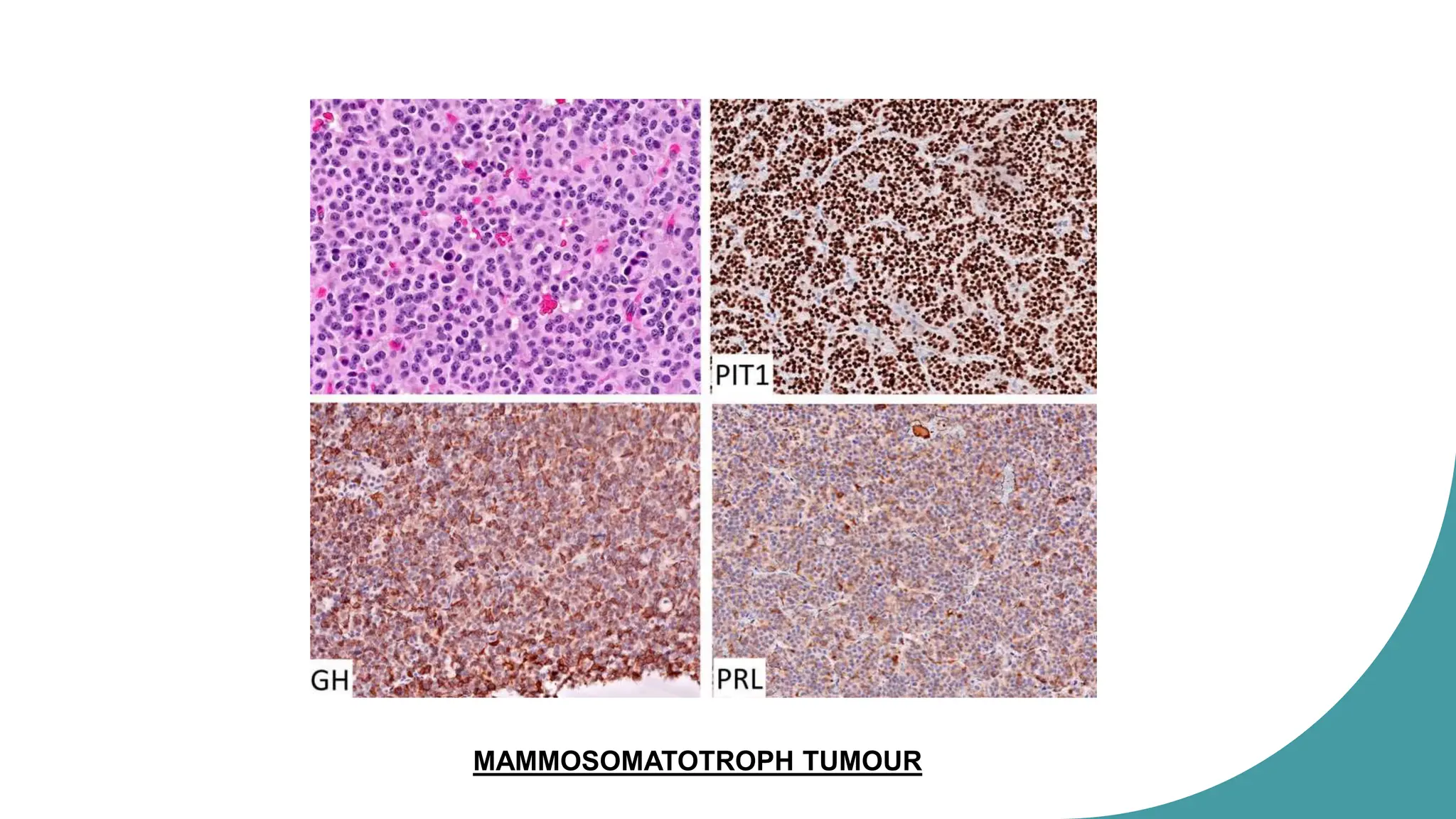Overview of the 2022 WHO Classification of Pituitary.pptx
