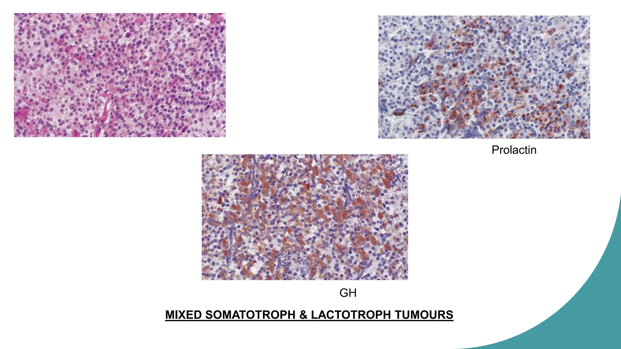 Overview of the 2022 WHO Classification of Pituitary.pptx