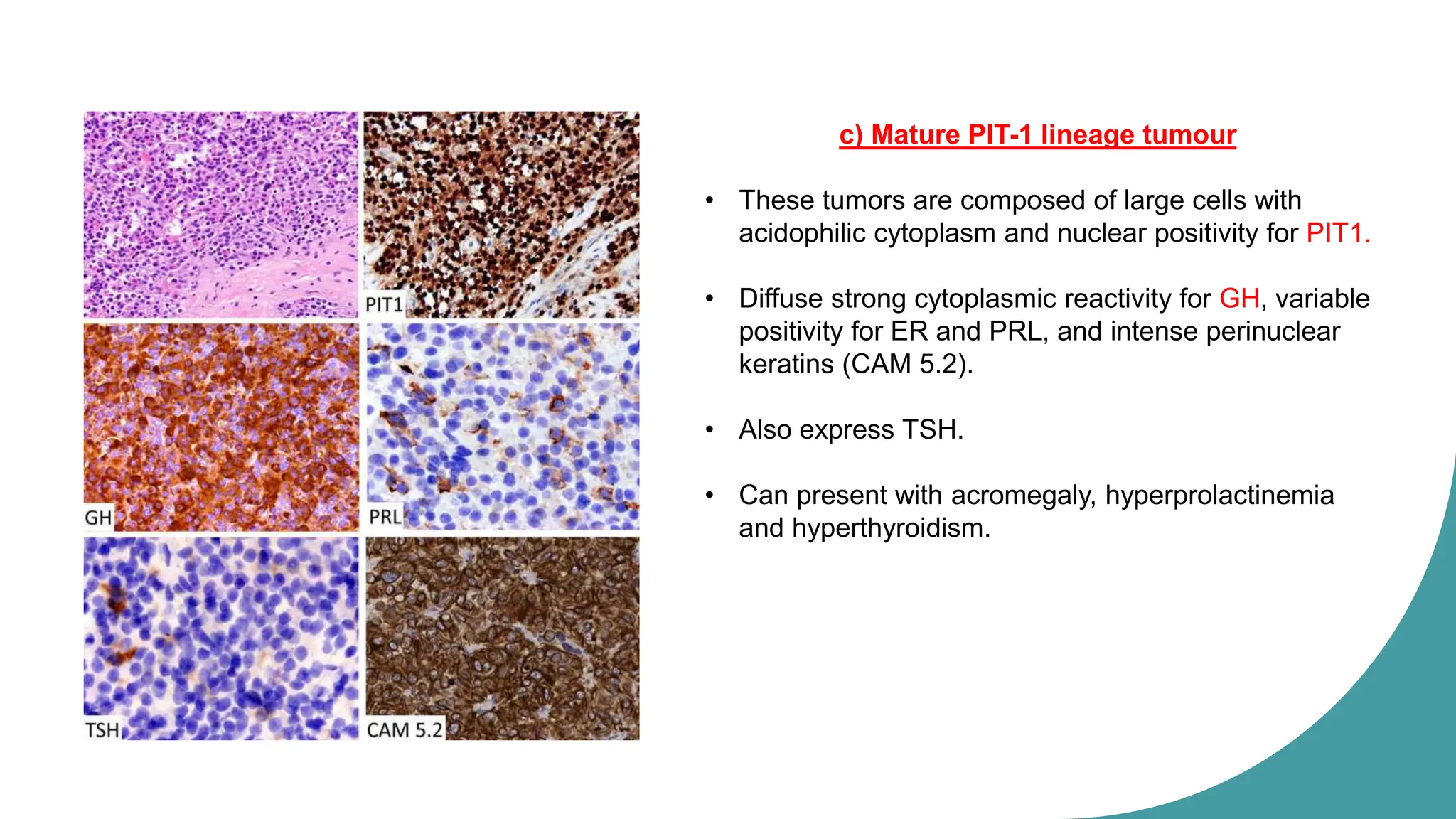 Overview of the 2022 WHO Classification of Pituitary.pptx