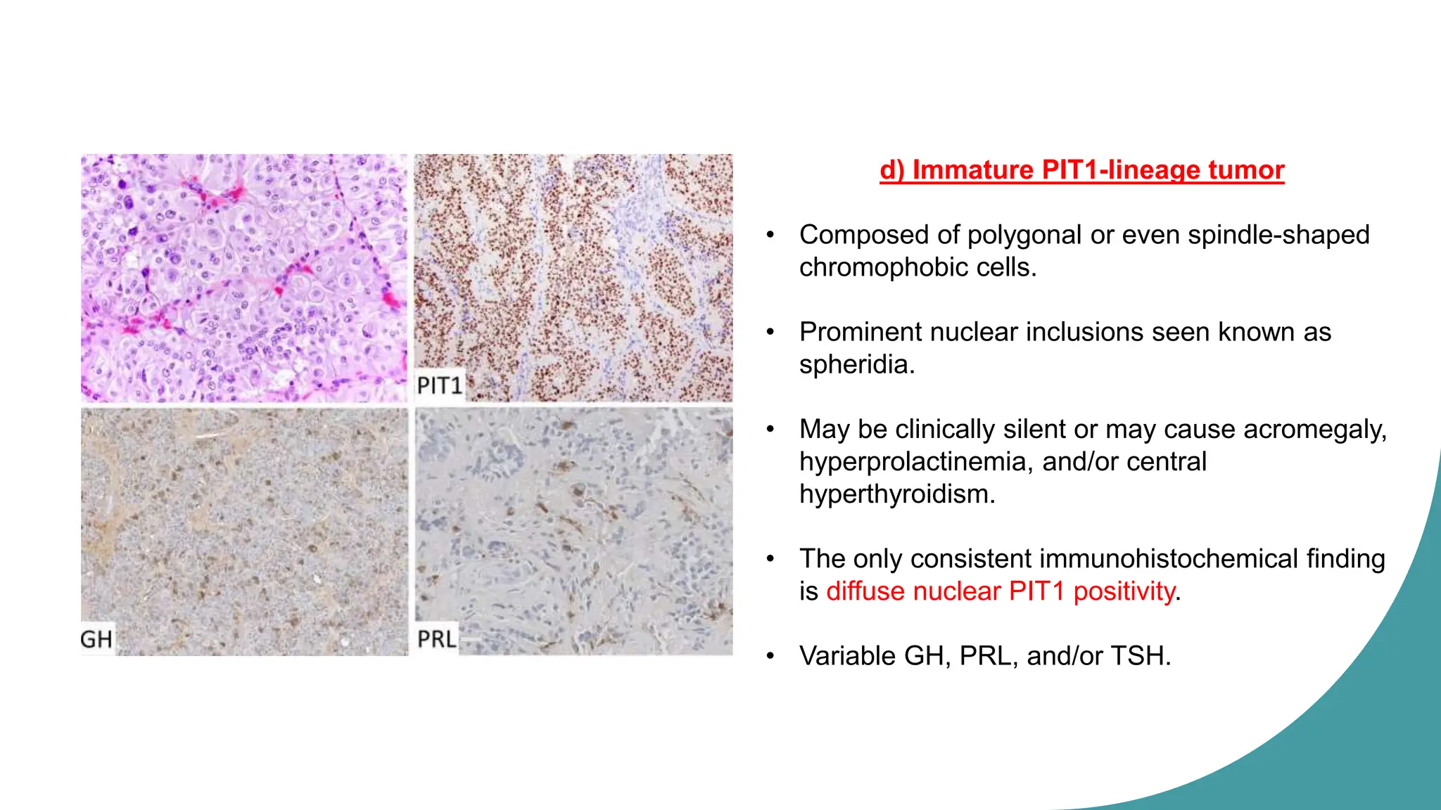 Overview of the 2022 WHO Classification of Pituitary.pptx