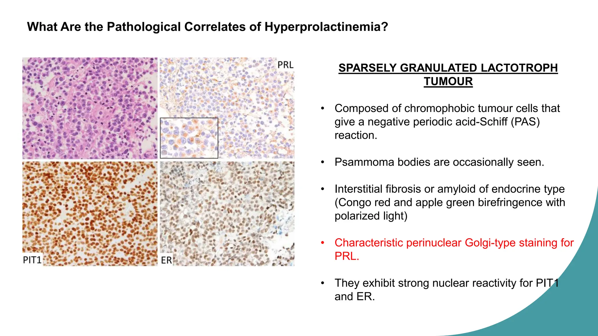 Overview of the 2022 WHO Classification of Pituitary.pptx