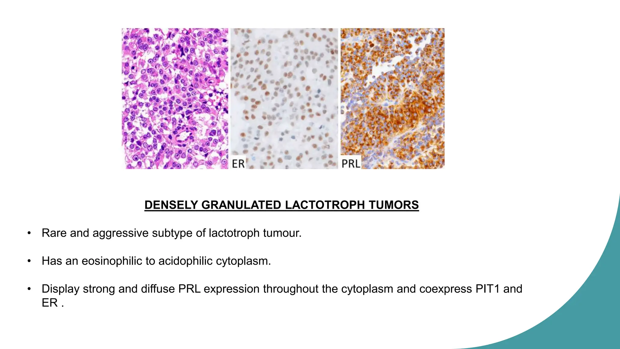 Overview of the 2022 WHO Classification of Pituitary.pptx