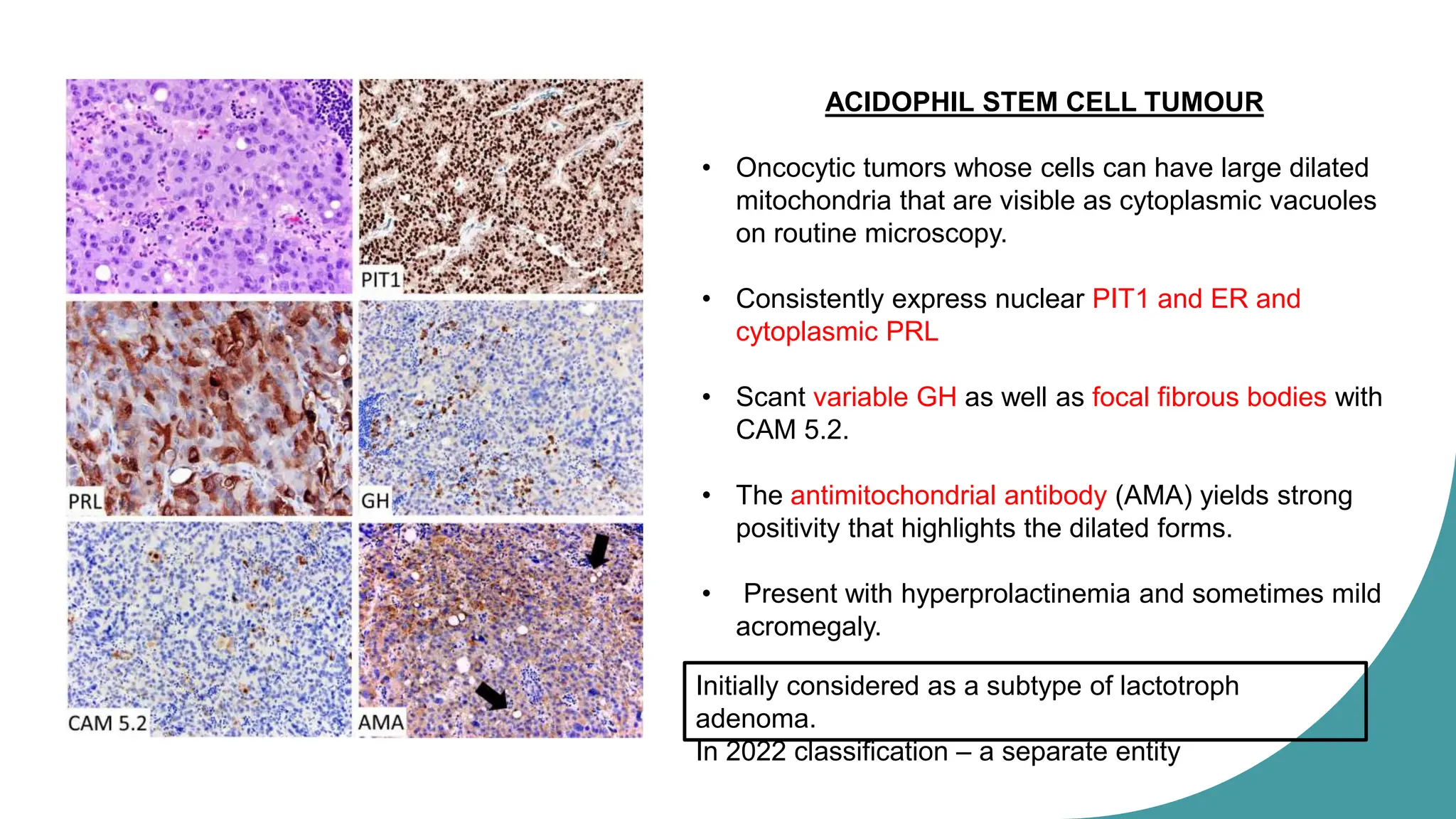 Overview of the 2022 WHO Classification of Pituitary.pptx