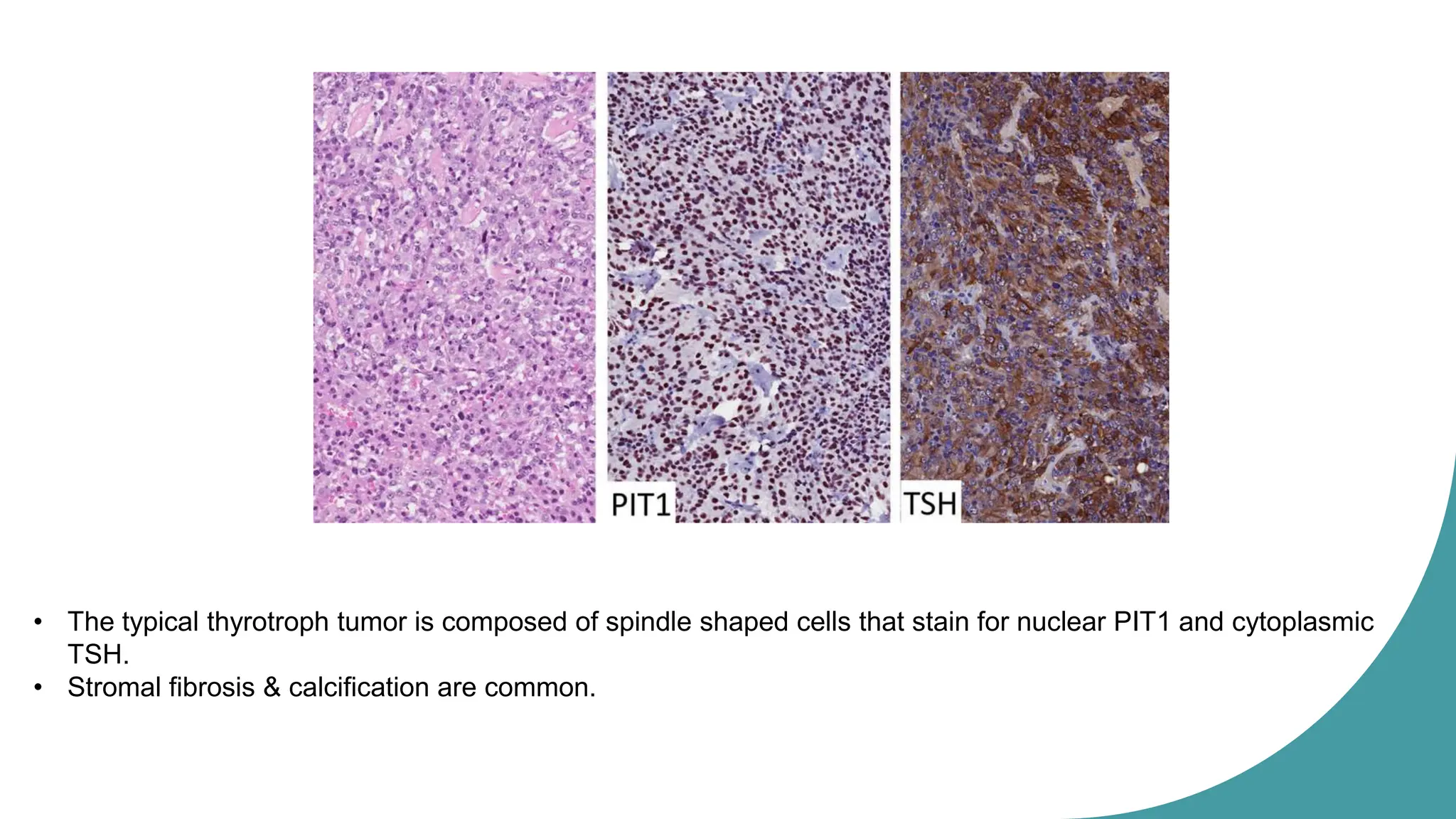 Overview of the 2022 WHO Classification of Pituitary.pptx