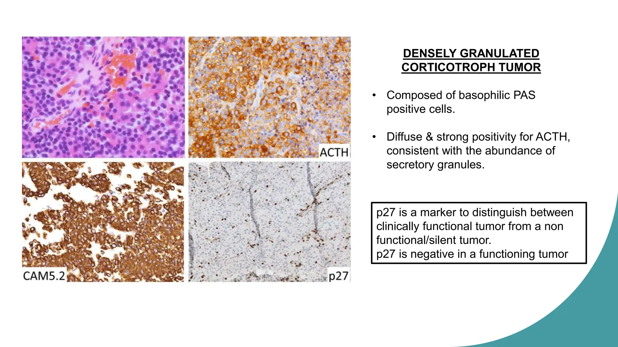 Overview of the 2022 WHO Classification of Pituitary.pptx