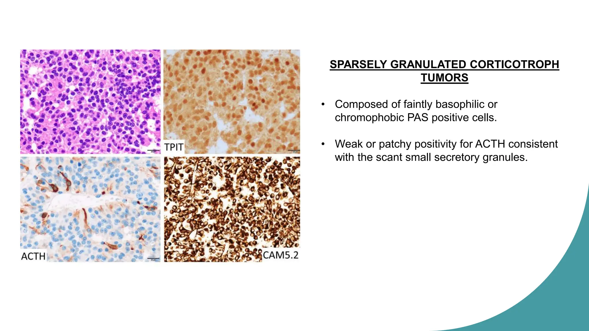 Overview of the 2022 WHO Classification of Pituitary.pptx