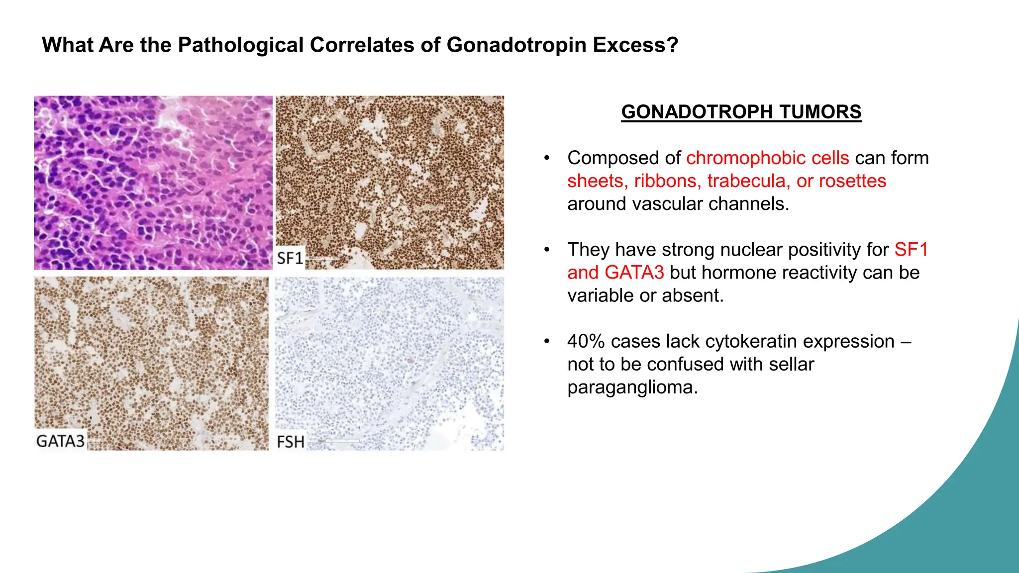 Overview of the 2022 WHO Classification of Pituitary.pptx