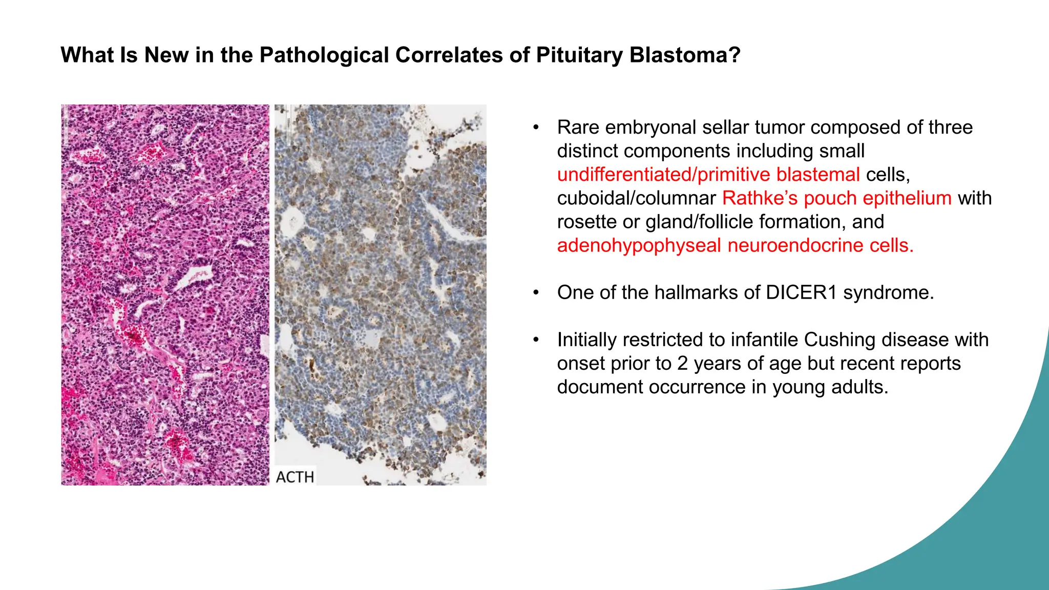 Overview of the 2022 WHO Classification of Pituitary.pptx