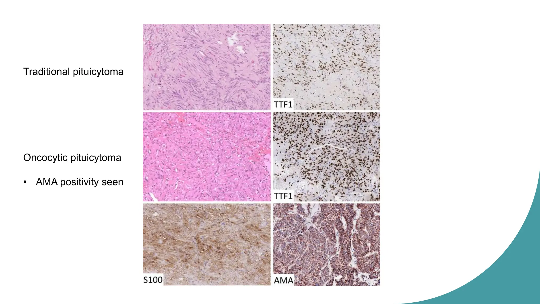 Overview of the 2022 WHO Classification of Pituitary.pptx