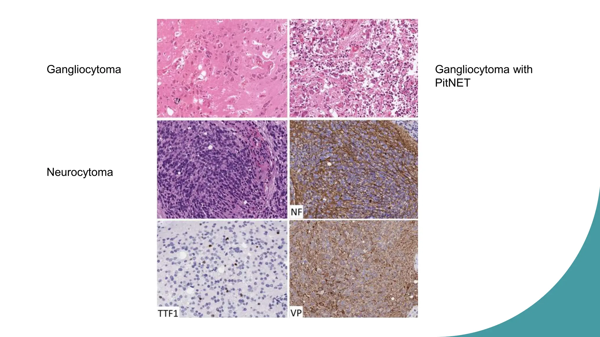 Overview of the 2022 WHO Classification of Pituitary.pptx