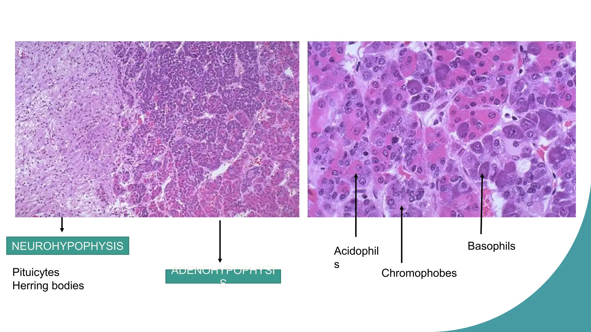 Overview of the 2022 WHO Classification of Pituitary.pptx