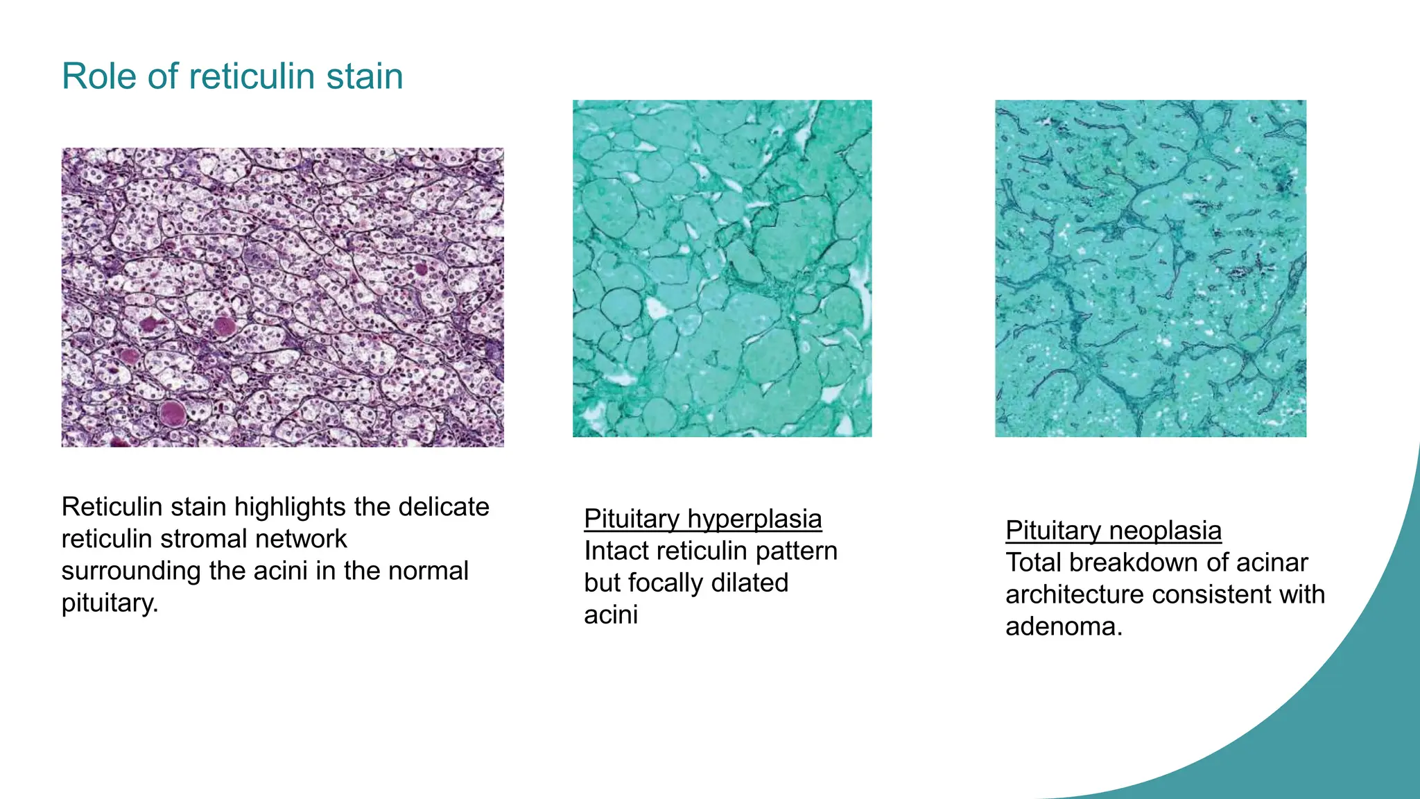 Overview of the 2022 WHO Classification of Pituitary.pptx