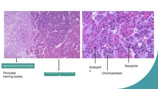 Overview of the 2022 WHO Classification of Pituitary.pptx