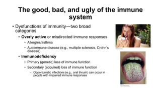 Overview of the immune system.pptx
