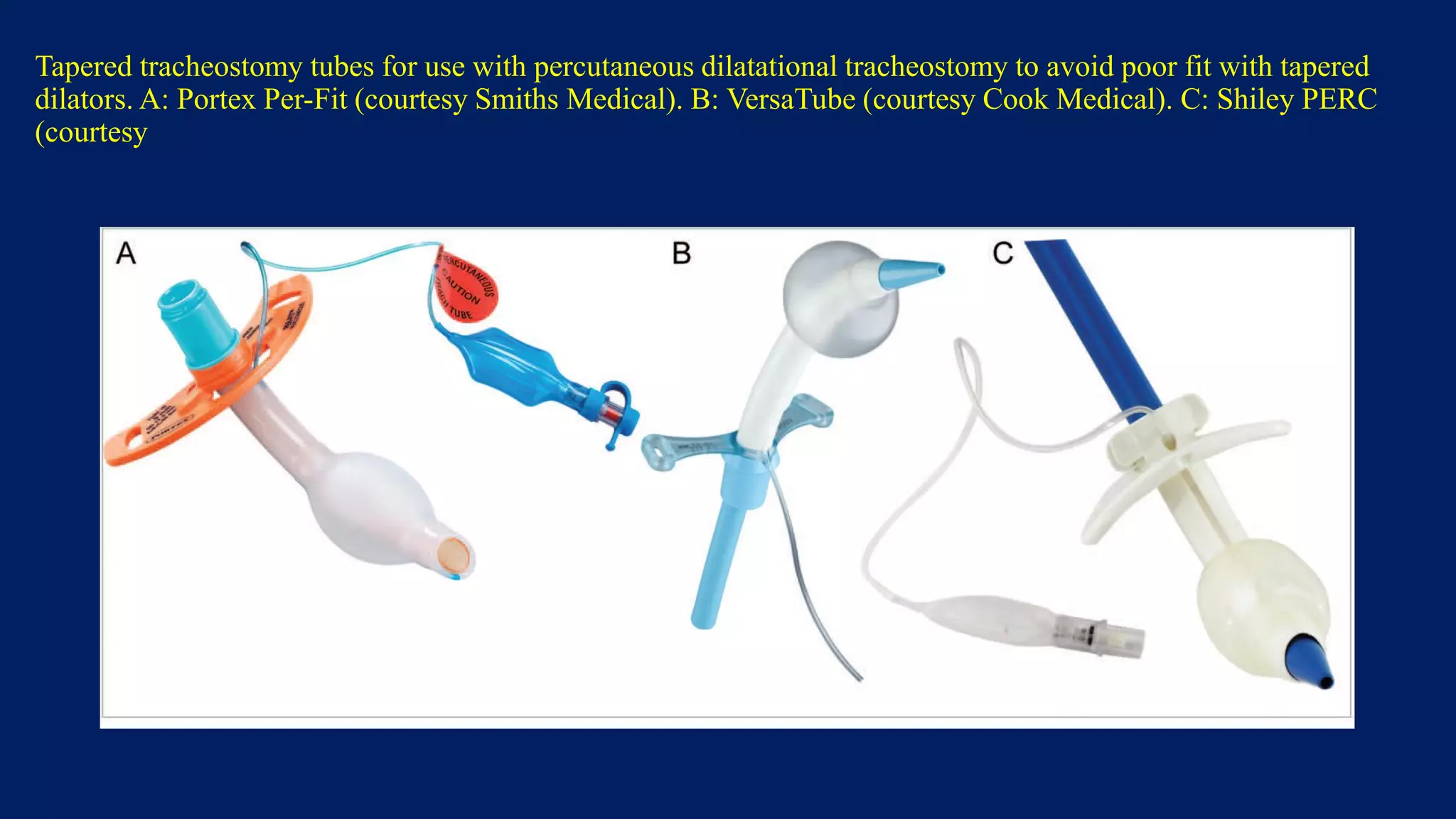Overview of tracheostomy | PDF
