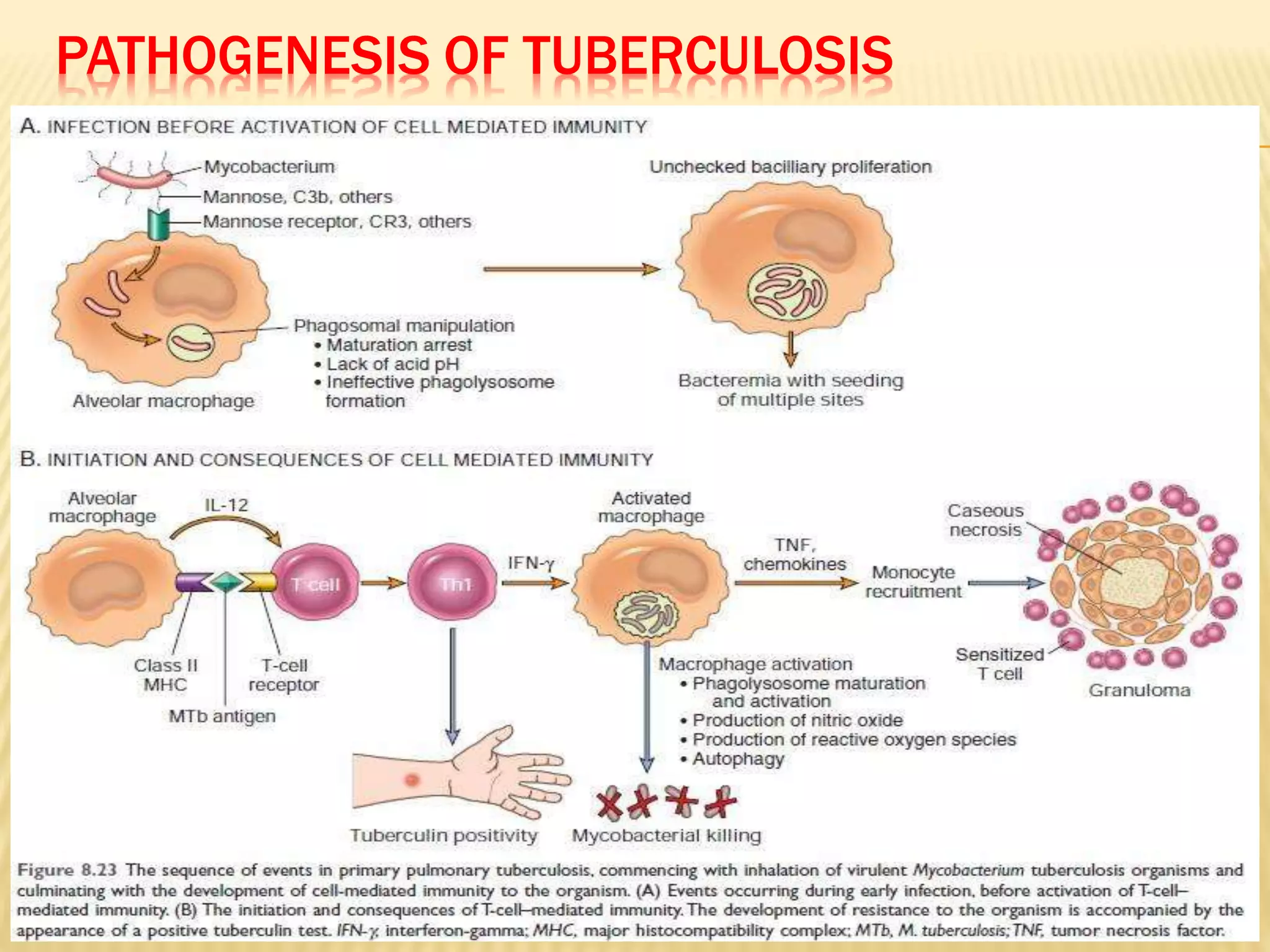 over view of tuberculosis.pptx