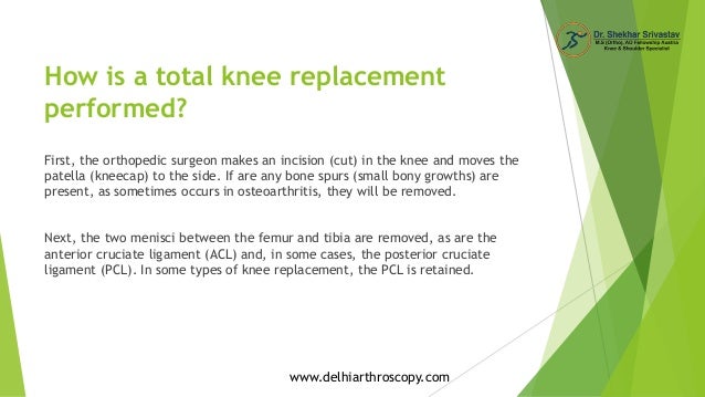 Overview on Knee Replacement surgery | PDF