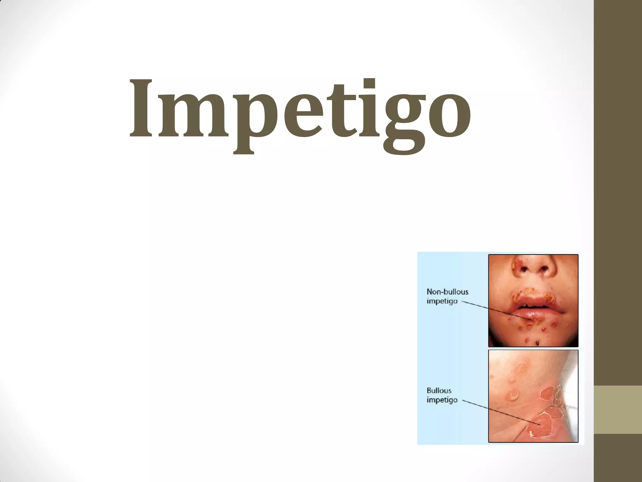 Overview skin disease & impetigo ping | PDF