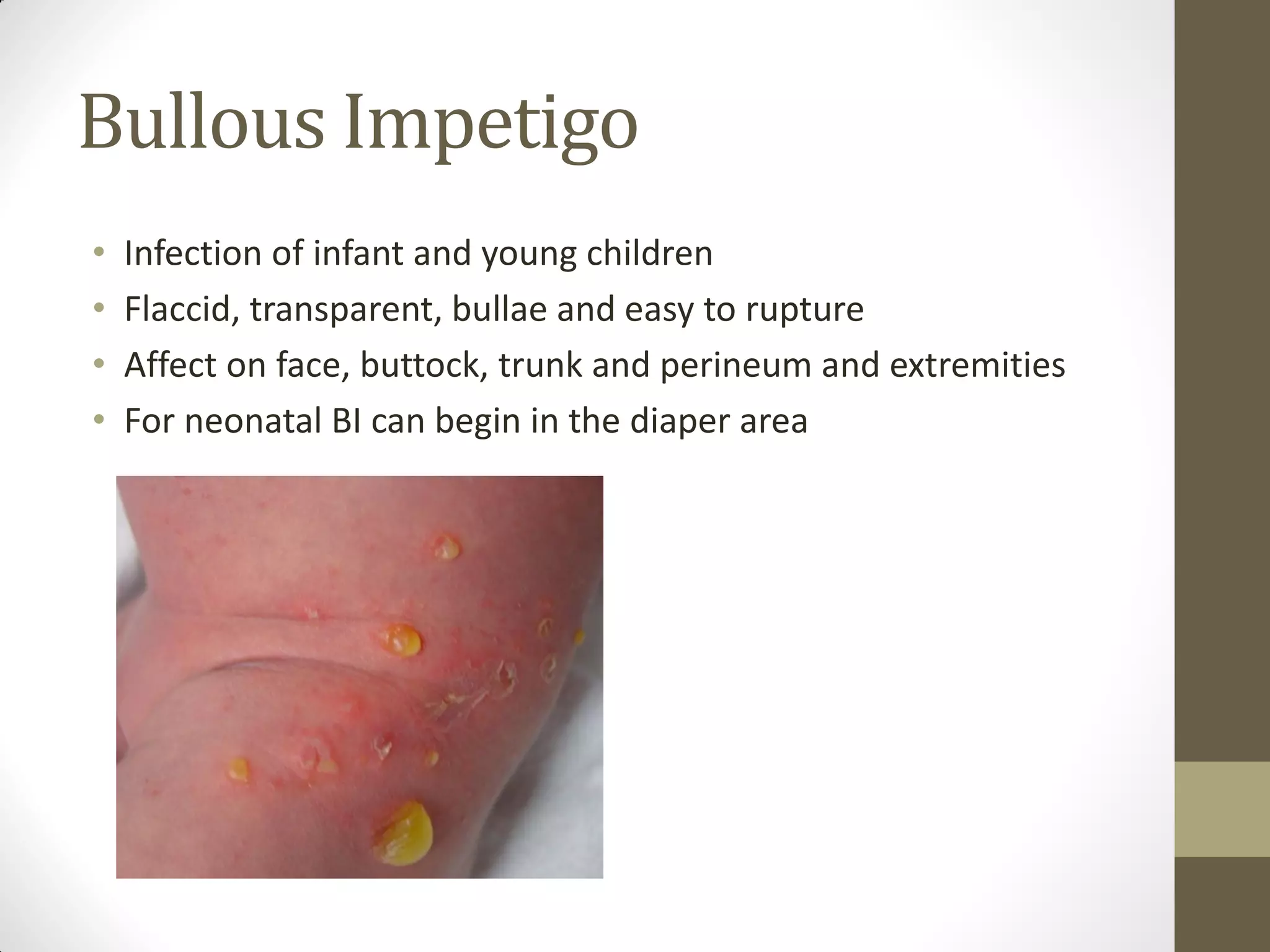 Overview skin disease & impetigo ping | PDF
