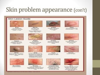 Overview skin disease & impetigo ping | PDF
