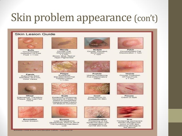 Overview skin disease & impetigo ping | PDF