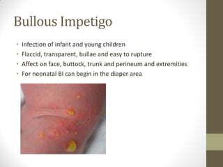 Overview skin disease & impetigo ping | PDF