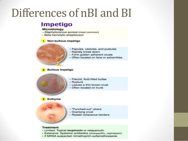 Overview skin disease & impetigo ping