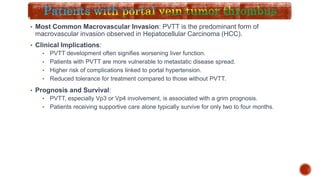Hepatocellular Carcinoma(HCC): Treatment option | PPTX