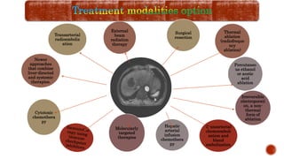 Hepatocellular Carcinoma(HCC): Treatment option | PPTX