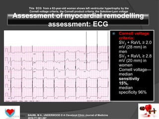 The Overworked Heart | PPTX | Heart and Cardiovascular Diseases ...