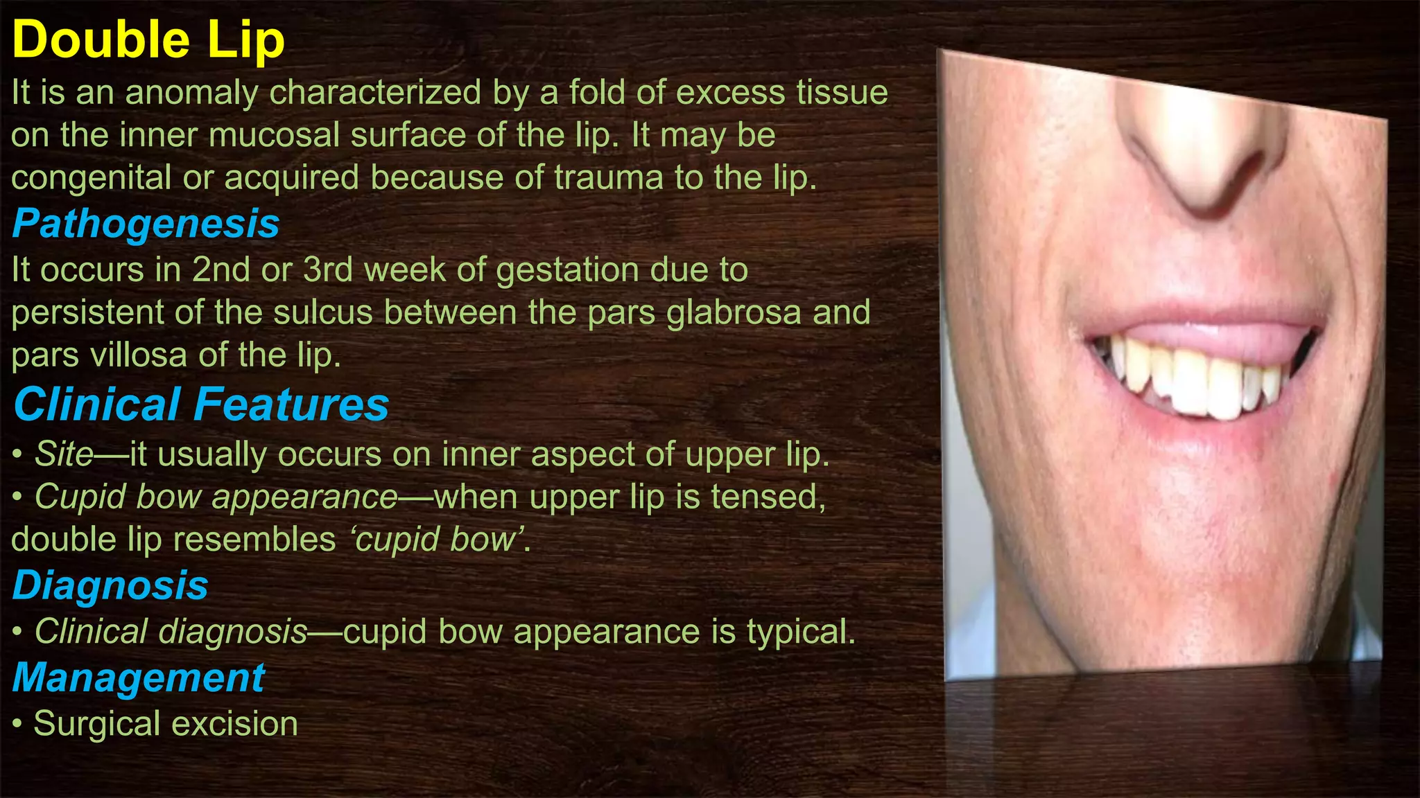 lesions of lip | PPTX