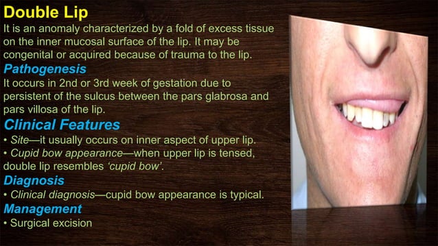 lesions of lip | PPTX | Ear, Nose and Throat Conditions | Diseases and ...