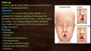 lesions of lip | PPTX