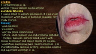 lesions of lip | PPTX