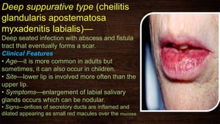 lesions of lip | PPTX