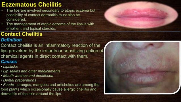 lesions of lip | PPTX | Ear, Nose and Throat Conditions | Diseases and ...