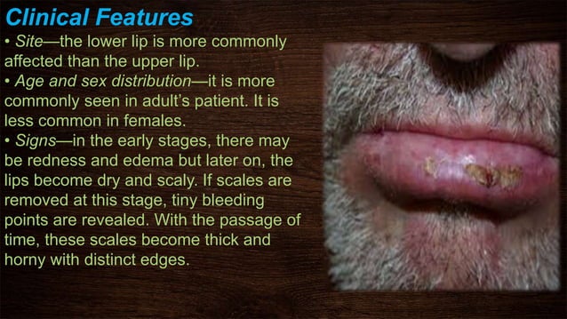 lesions of lip | PPTX | Ear, Nose and Throat Conditions | Diseases and ...