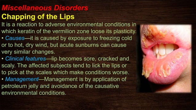lesions of lip | PPTX | Ear, Nose and Throat Conditions | Diseases and ...
