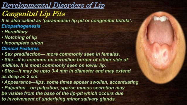 lesions of lip | PPTX | Ear, Nose and Throat Conditions | Diseases and ...