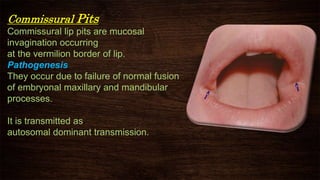 lesions of lip | PPTX