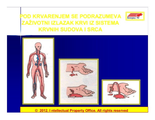 Krvarenje i zbrinjavanje rane