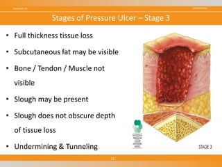 Wound Management | PPTX