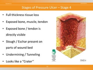 Wound Management | PPTX