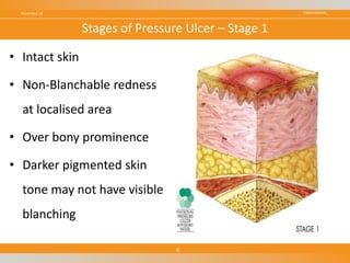 Wound Management | PPTX