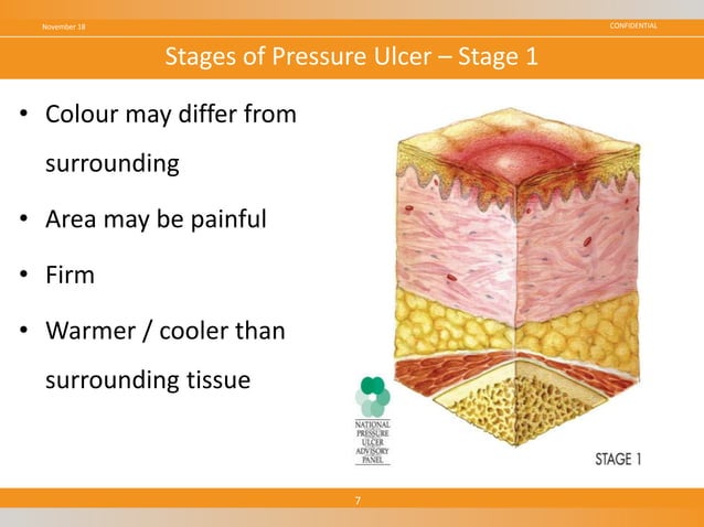 Wound Management | PPT