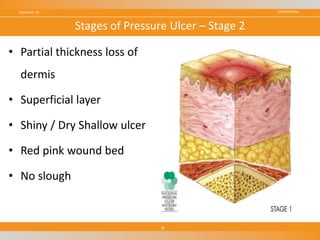 Wound Management | PPTX
