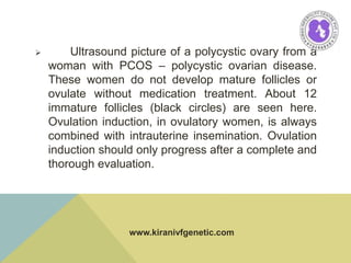 Ovulation induction | PPTX