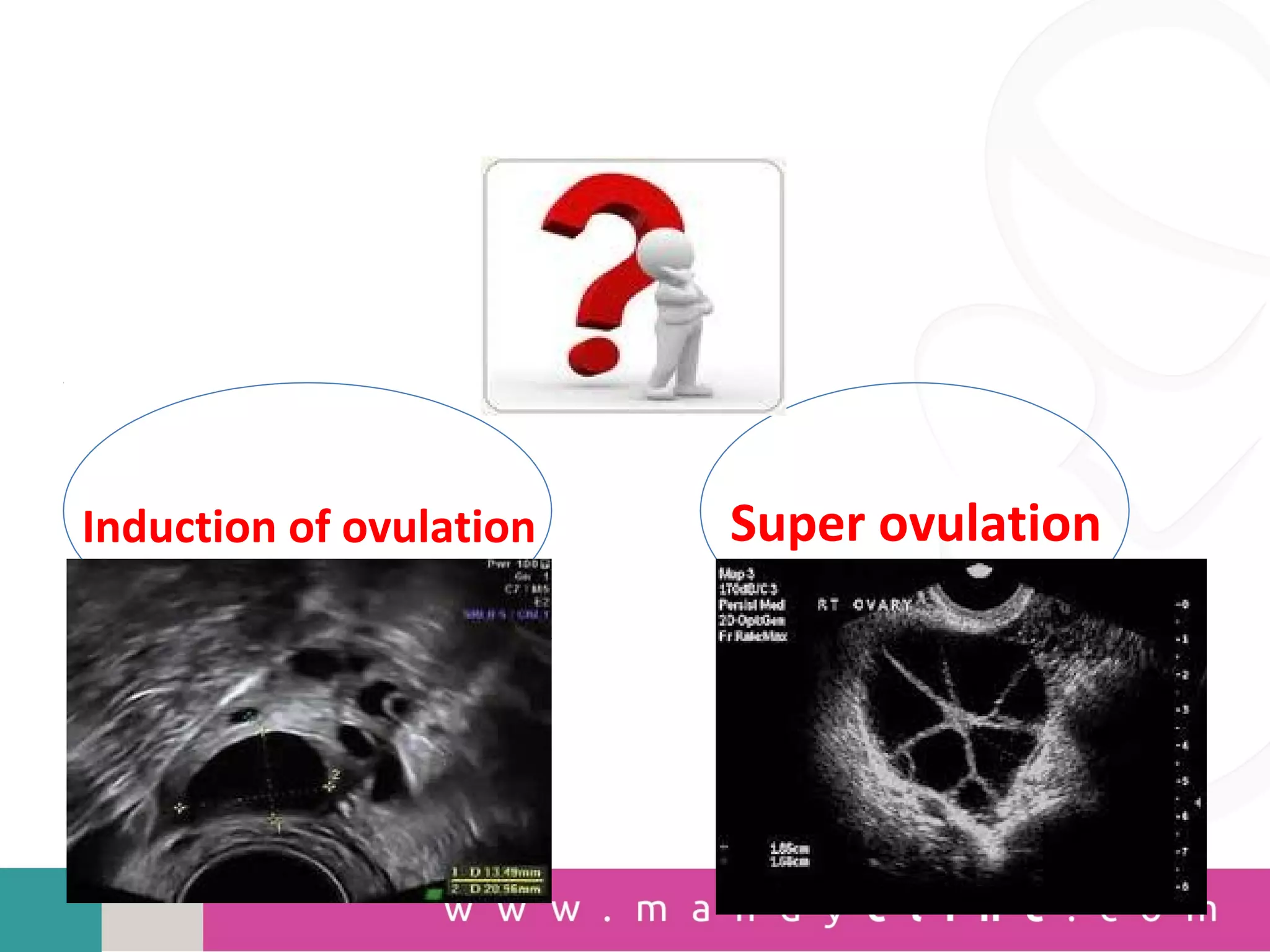Ovulation induction | PPT